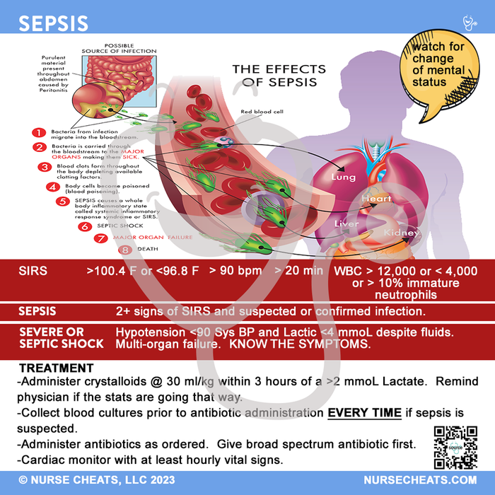 SEPSIS Badge Buddy for Inpatient Nurses